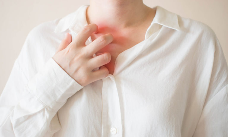 Radiodermite: o que é, tratamentos e cuidados - Revista Online ABRALE