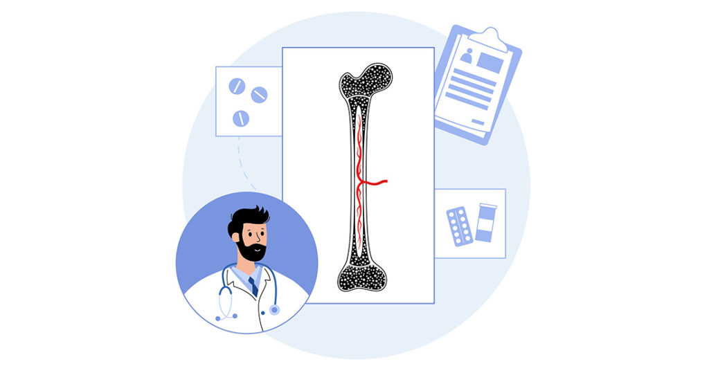 Transplante de medula óssea: tipos e indicações - Revista Online ABRALE