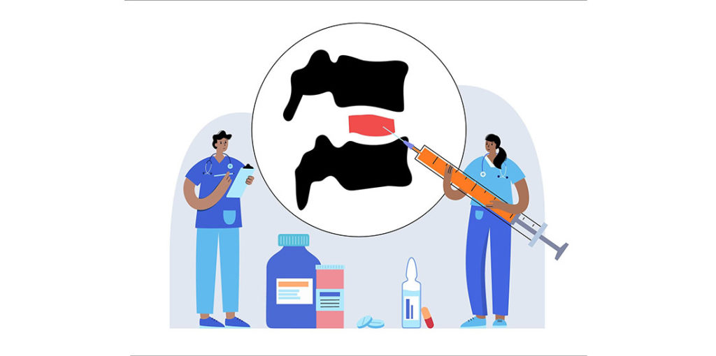 Quimioterapia intratecal: o que é e quando usar - Revista Online ABRALE