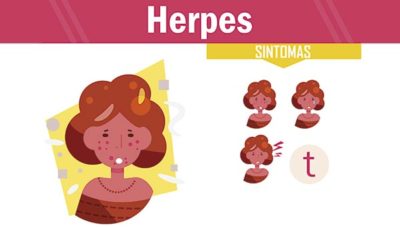 Herpes zoster e câncer: qual a ligação e tratamentos - Revista Online ...